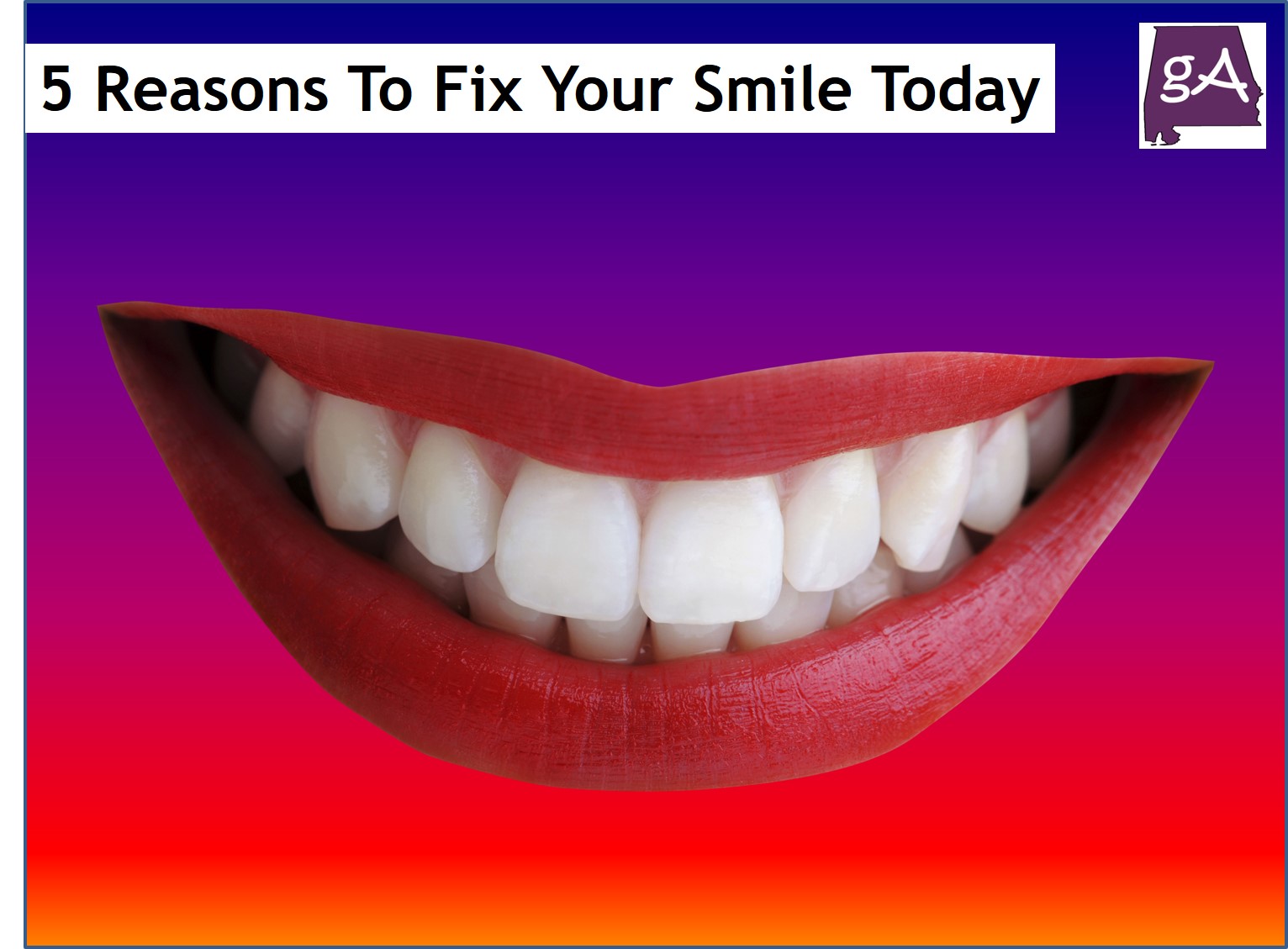 5 Reasons Why You Should Fix Your Smile Today - Geek Alabama
