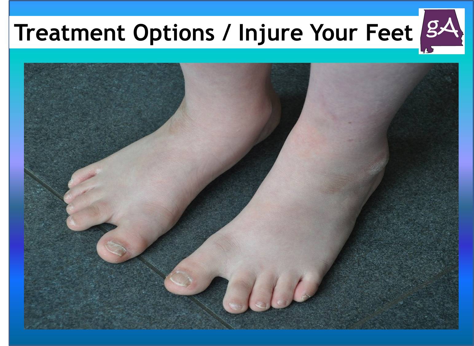 5 Treatment Options To Explore When You Injure Your Feet - Geek Alabama
